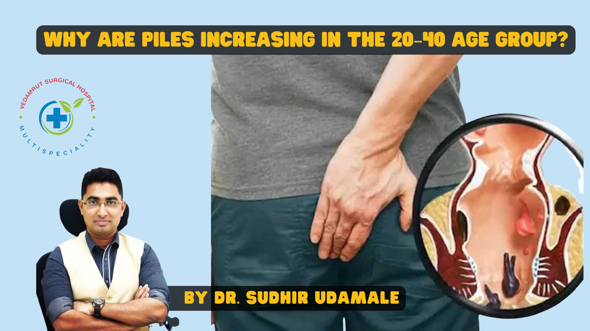 Why Are Piles Increasing in the 20–40 Age Group? Real Lifestyle ...