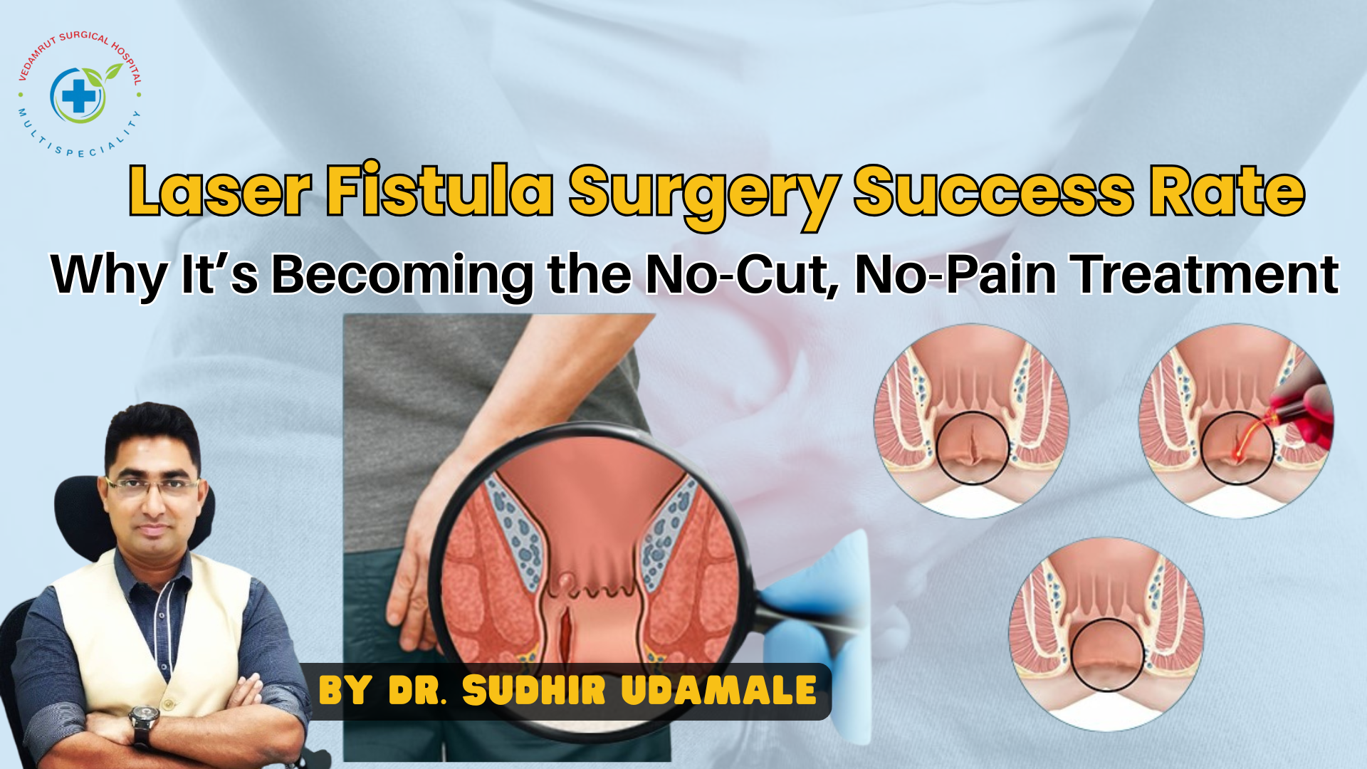 Laser Fistula Surgery Success Rate | No-Cut, No-Pain Fistula Treatment ...